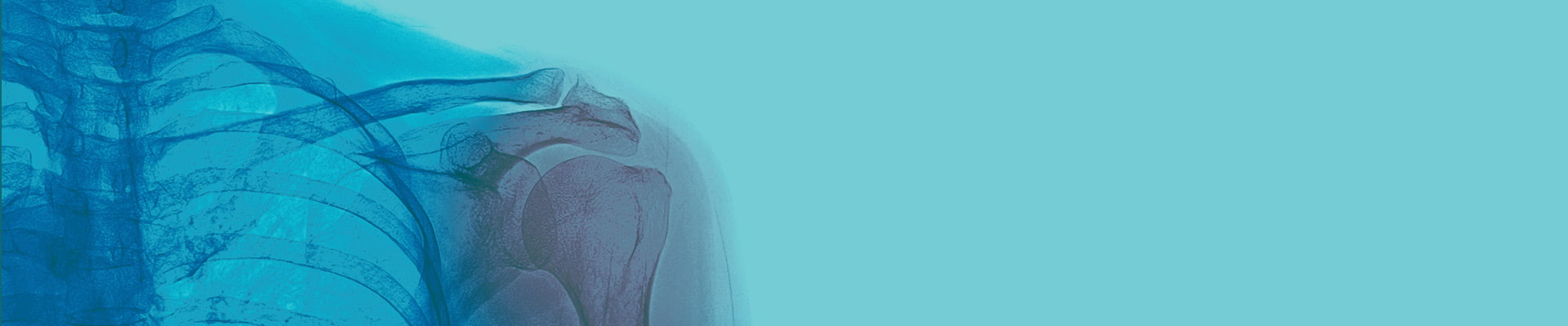 Shoulder Treatments, Shoulder Treatments In Redding